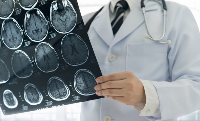 Neuroradiology - Chattanooga Imaging