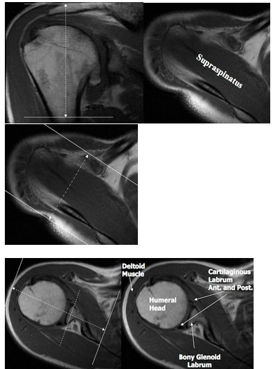 CT Upper Extremities - Chattanooga Imaging