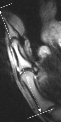 CT Upper Extremities - Chattanooga Imaging