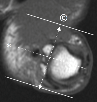 CT Upper Extremities - Chattanooga Imaging
